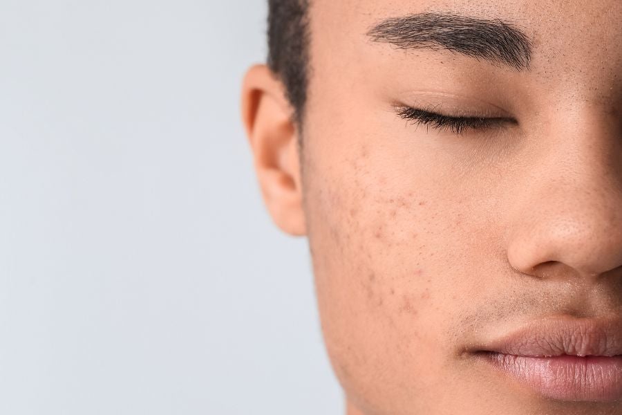 pH da pele: o que é, sua importância e como equilibrar